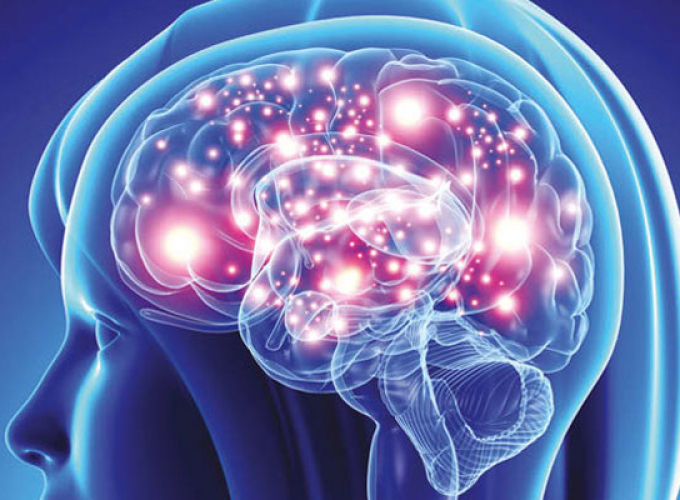 Arteriovenous malformation (AVM) - Support for neurological conditions ...