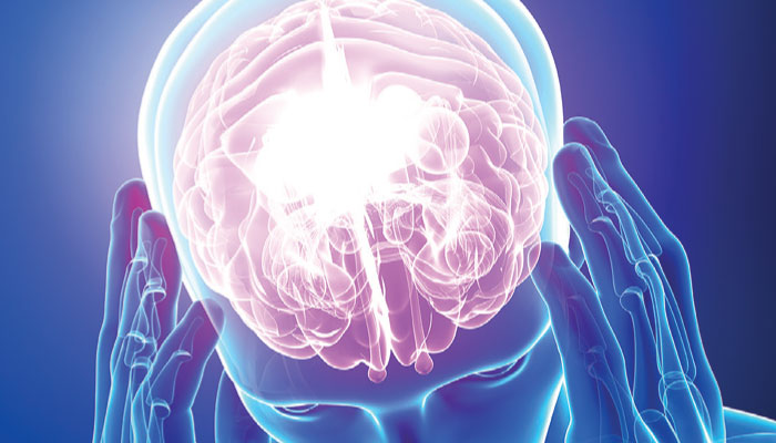 What is neuroplasticity? The brain's incredible ability to change ...