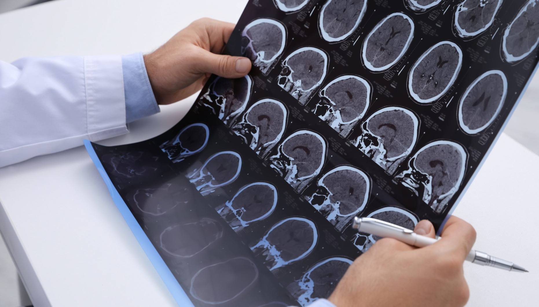 Multiple Sclerosis: facts vs fiction - Support for neurological ...